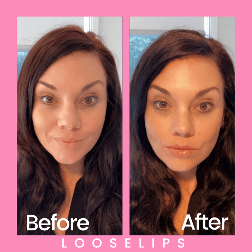 LOOSELIPS – LOOSELIPS SKINCARE